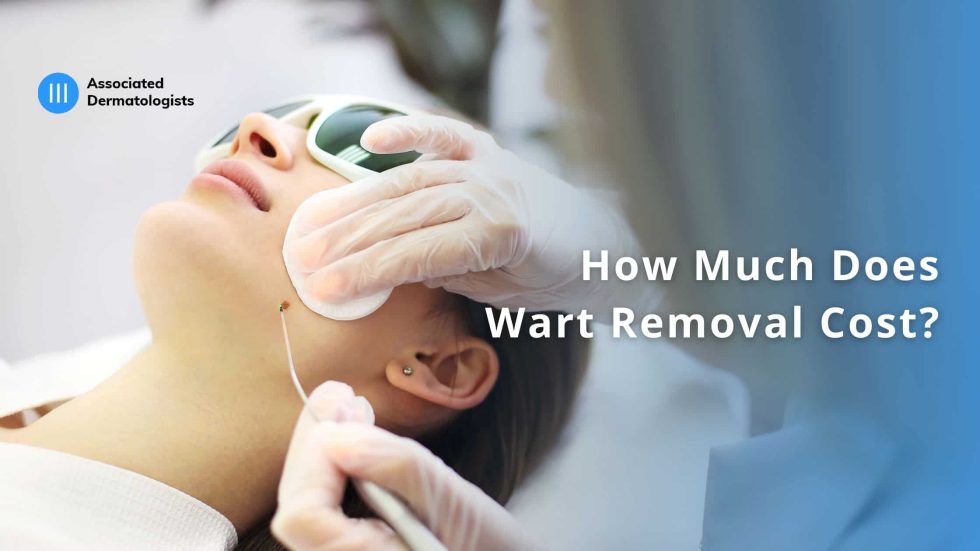How Much Does Wart Removal Cost?